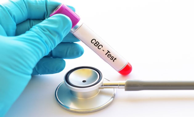 How To Check Blood Count Faultconcern7