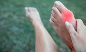 Bunions And Toe Troubles: 4 Possible Causes - Tata 1mg Capsules