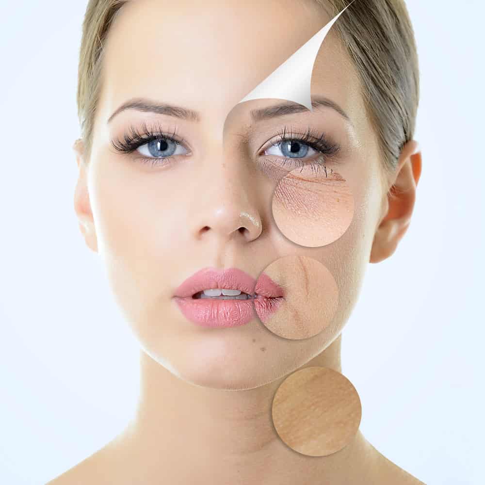 B12 Deficiency Cause Skin Problems - Infoupdate.org