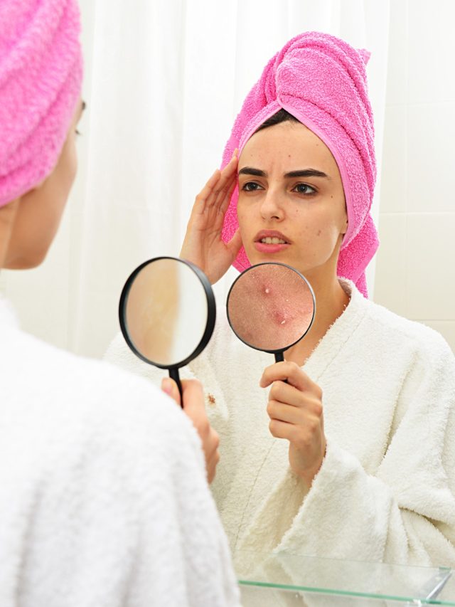 5 Tips To Clear Hormonal Acne Tata 1mg Capsules
